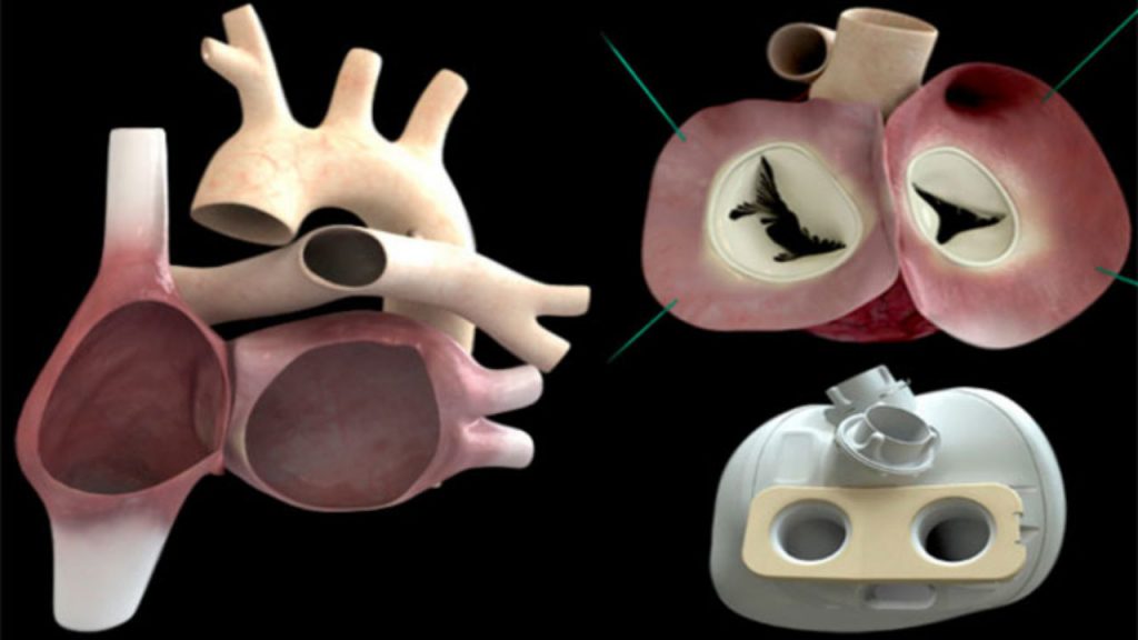 Como hacer un corazon humano con material reciclable - Diario Santander